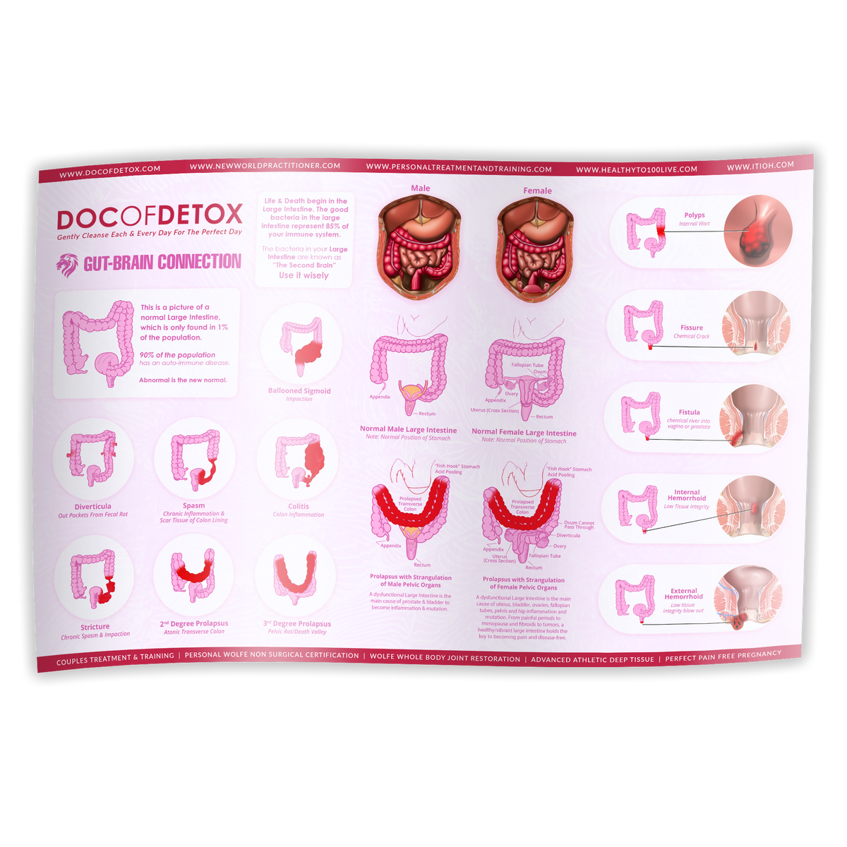 Posters (Digestive Tract and Colon Chart) – Doc of Detox